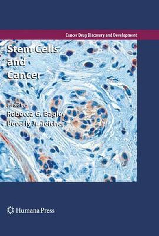 Stem Cells and Cancer | 9781617379208 | Boeken | bol