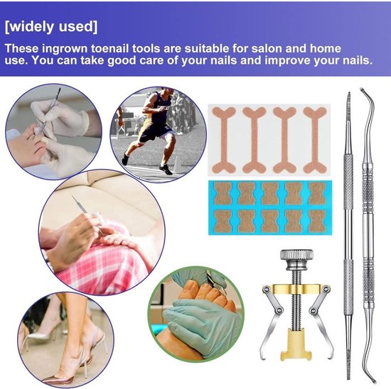 Corrector voor Ingegroeide Teennagels - Gereedschapsset inclusief ...