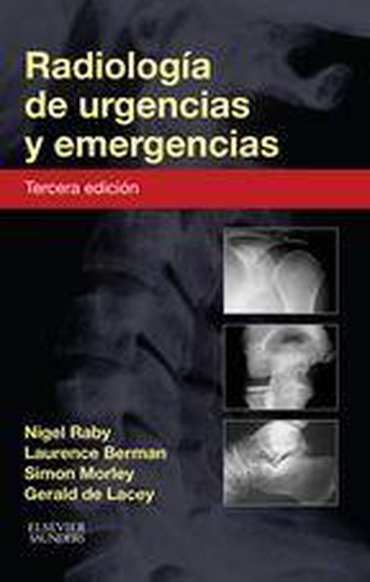 Radiología de urgencias y emergencias (ebook), Nigel Raby, Frcr ...