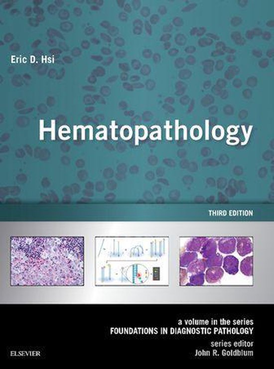 Foundations in Diagnostic Pathology - Hematopathology (ebook), Eric D ...