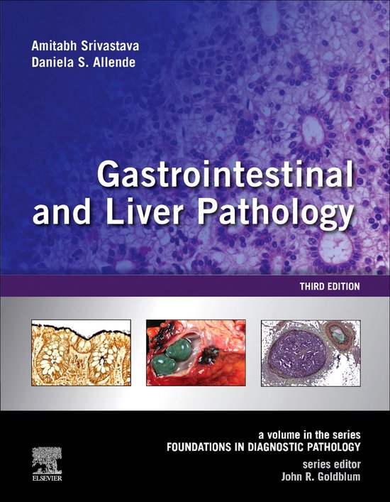 Foundations in Diagnostic Pathology - Gastrointestinal and Liver ...