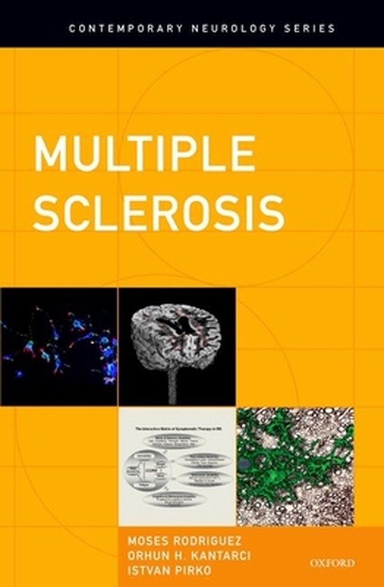 Multiple Sclerosis | 9780199740468 | Moses Rodriguez | Boeken | bol.com