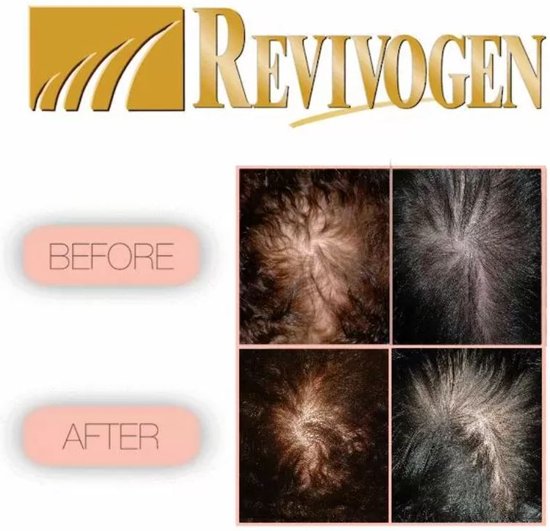 Revivogen Anti-Haaruitval set - Haargroei serum - Haaruitval Shampoo en ...