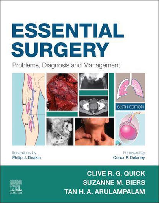 Essential Surgery E-Book (ebook) | 9780702076336 | Boeken | bol.com