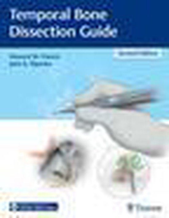 Temporal Bone Dissection Guide (ebook), Howard W. Francis | 9781626232709 | Boeken | bol