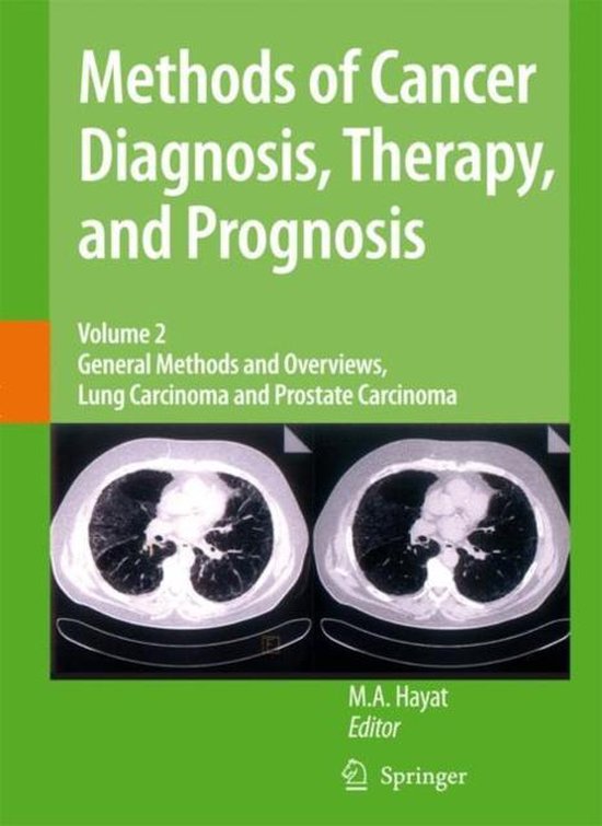 Methods of Cancer Diagnosis, Therapy and Prognosis- Methods of Cancer ...