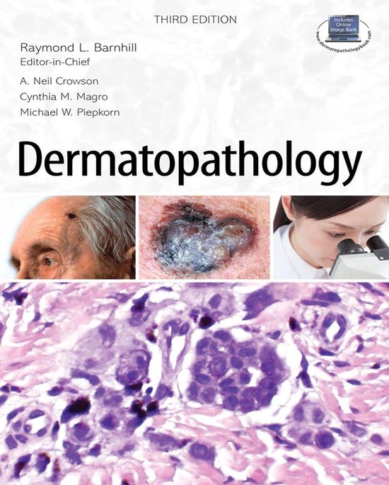 Dermatopathology: Third Edition (ebook), Cynthia M. Magro ...