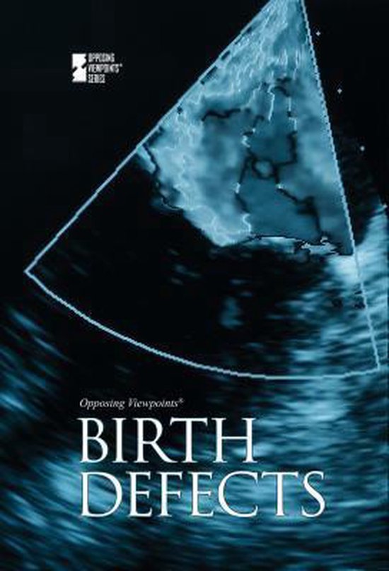 Birth Defects | 9780737745047 | Noel Merino | Boeken | bol.com