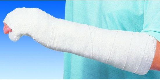 Idealast Windsel 5Mx 8Cm | bol