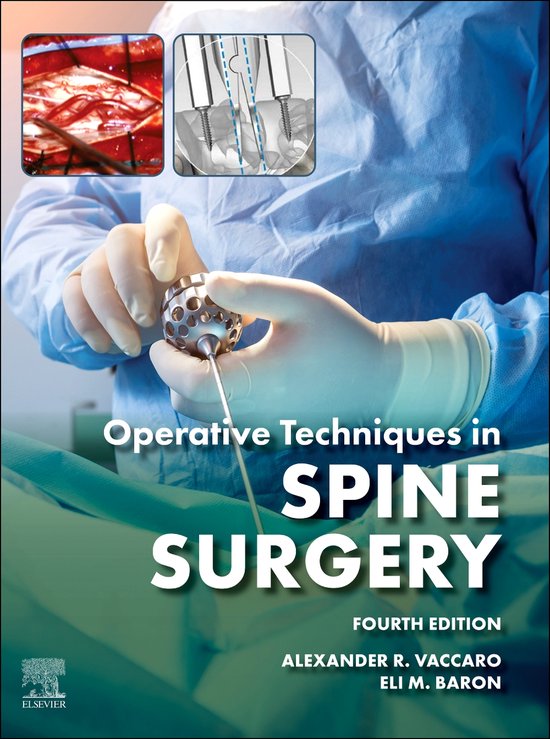 Operative Techniques - Operative Techniques: Spine Surgery E-Book ...