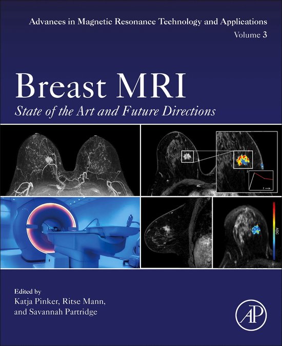 Breast MRI (ebook) | 9780128227497 | Boeken | bol.com