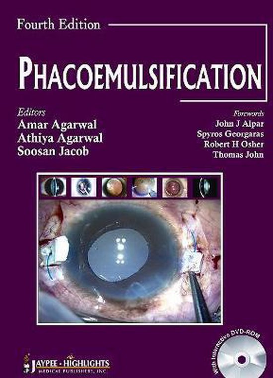 Phacoemulsification, Fourth Edition | 9789350254837 | Amar Agarwal ...