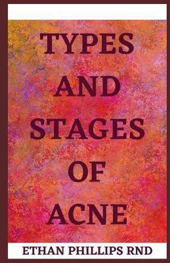 Types and Stages of Acne, Ethan Phillips Rnd | 9798672001159 | Boeken ...