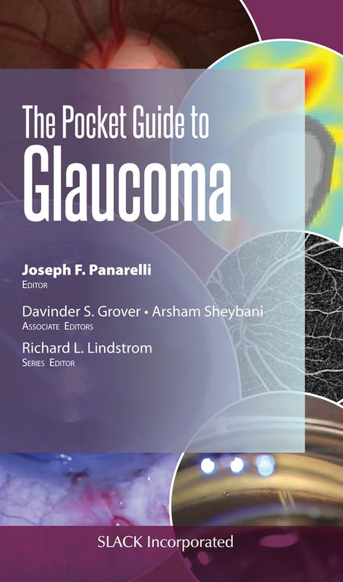 Pocket Guides-The Pocket Guide to Glaucoma | 9781630916701 | Joseph F ...