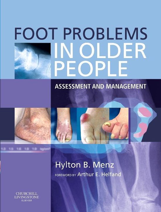 Foot Problems In Older People | 9780080450322 | Hylton Menz | Boeken ...