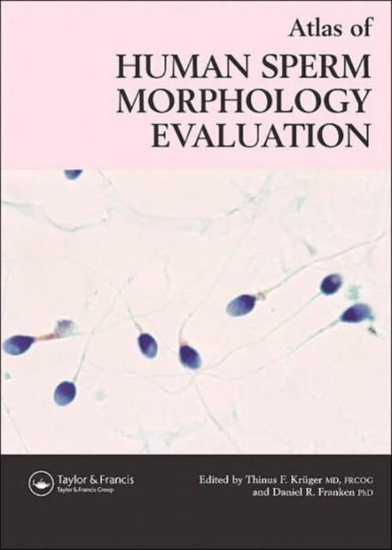 Atlas of Human Sperm Morphology Evaluation | 9781842142776 | Thinus F ...