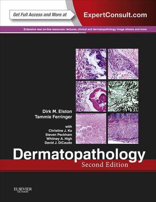Dermatopathology E-Book (ebook), Dirk Elston | 9780702055287 | Boeken | bol.com