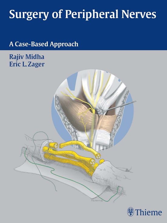 Surgery of Peripheral Nerves (ebook), Rajiv Midha | 9781638533511 ...