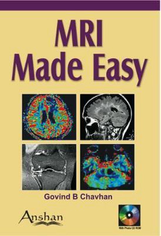 Mri Made Easy | 9781905740611 | Govind B Chavhan | Boeken | bol