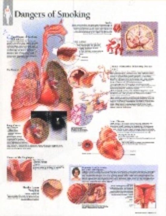 Effects of Smoking, Laminated Chart | bol.com