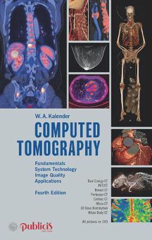 Computed Tomography | 9783895784712 | Willi A. Kalender | Boeken | bol.com