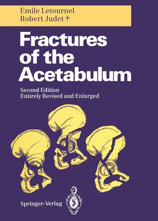 Fractures of the Acetabulum (ebook), Emile Letournel | 9783642754357 ...