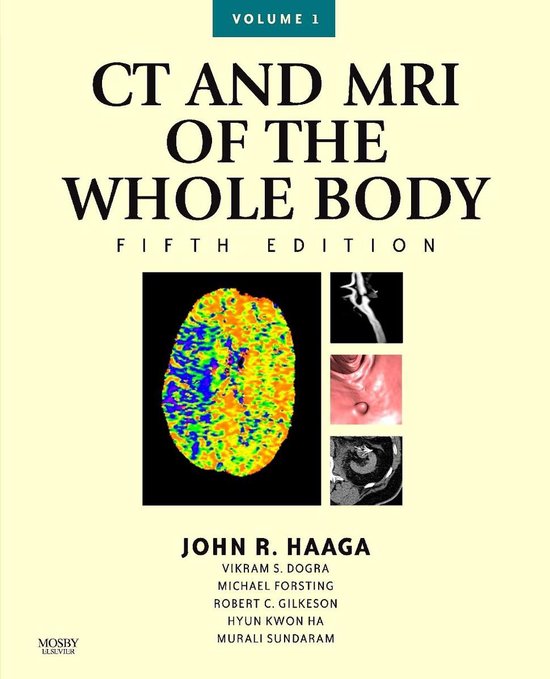 CT and MRI of the Whole Body, 2-Volume Set, John R. Haaga, Md, Facr ...