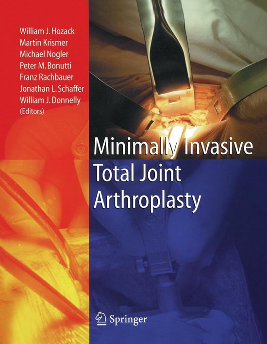 Minimally Invasive Total Joint Arthroplasty (ebook), William J. Hozack ...