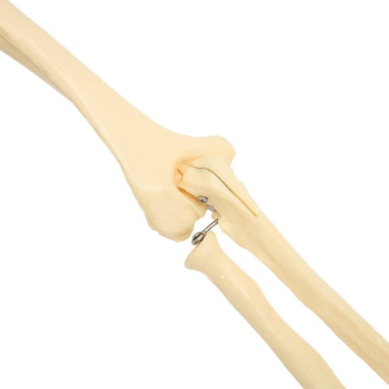 Professioneel Menselijk Arm Been Model - Anatomisch Bovenste Ledemaat ...