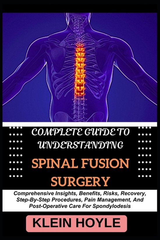 Complete Guide to Understanding Spinal Fusion Surgery, Klein Hoyle ...