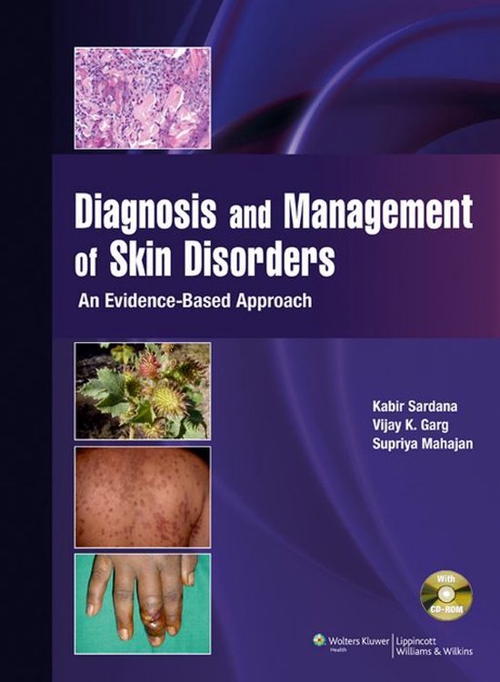 Diagnosis & Management of Skin Disorders (ebook), Kabir Sardana | 9781469819273 | Boeken | bol.com