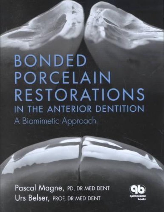 Bonded Porcelain Restorations in the Anterior Dentition | 9780867154221 ...