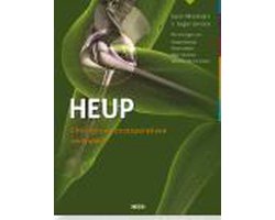 Welke klachten heb je bij een versleten heup? Ontdek de symptomen!