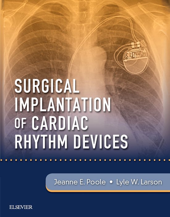 Surgical Implantation of Cardiac Rhythm Devices (ebook), Jeanne Poole ...