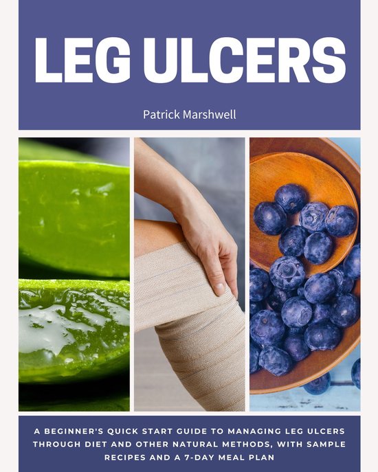 Leg Ulcer (ebook), Patrick Marshwell | 6610000400546 | Boeken | bol