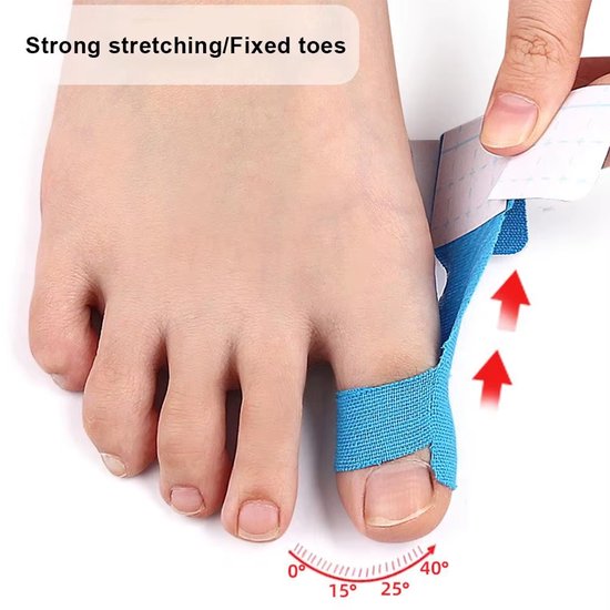 10 Stuks Tape tegen Hallux Valgus (Scheefstand Grote Teen) – Bunion ...