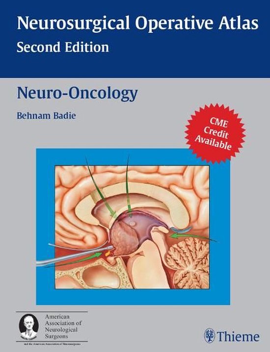 Neuro-Oncology (ebook), Behnam Badie | 9781604065602 | Boeken | bol.com