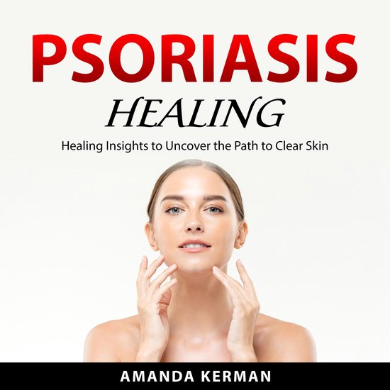 Psoriasis Healing, Amanda Kerman | 9798875167225 | Boeken | bol