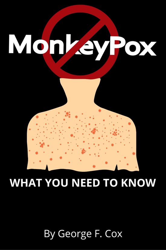 Monkeypox (ebook), George F. Cox | 1230005852154 | Boeken | bol.com