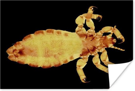 Vues microscopiques de poux poster papier 160x120 cm - Tirage photo sur ...