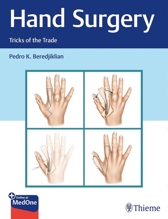 Hand Surgery (ebook), Pedro Beredjiklian | 9781638534532 | Boeken | bol