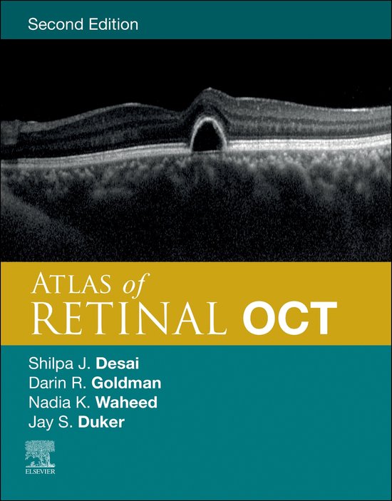 Atlas of Retinal OCT: Optical Coherence Tomography (ebook ...