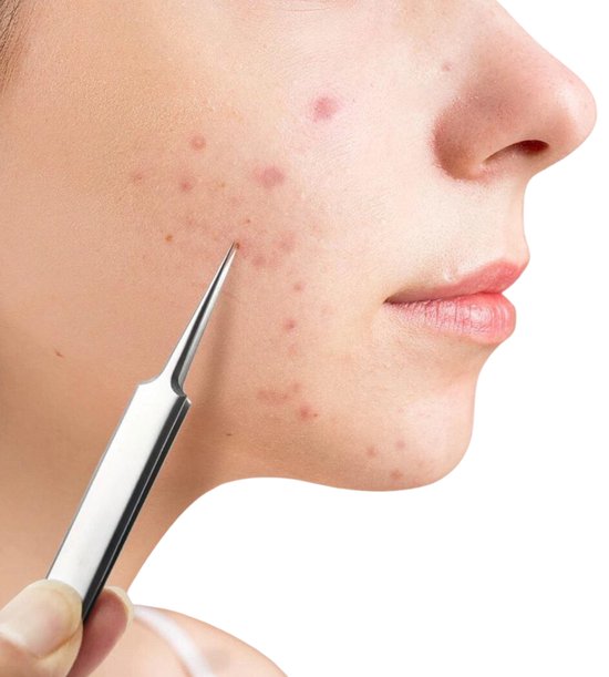 Viamart® - Ultrafijn Pincet - Tweezer - RVS - Huidverzorging ...