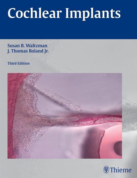 Cochlear Implants (ebook) | 9781604069068 | Boeken | bol.com