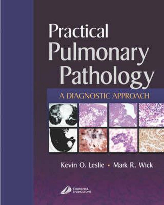 Practical Pulmonary Pathology, Kevin O. Leslie | 9780443066313 | Boeken ... Practical Pulmonary Pathology, Kevin O. Leslie | 9780443066313 | Boeken ...