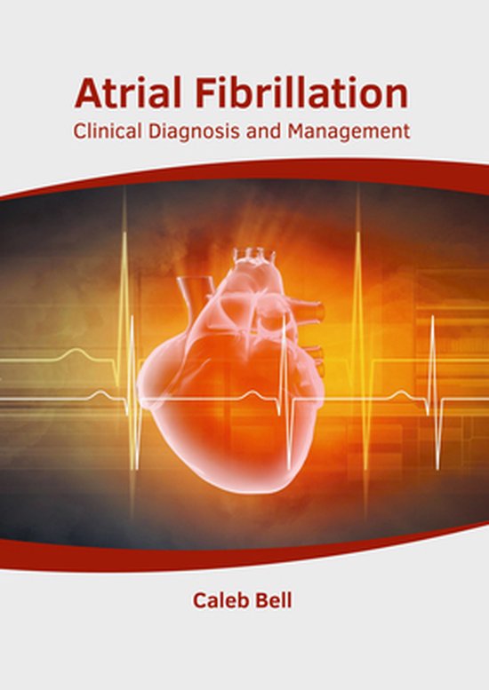 Atrial Fibrillation: Clinical Diagnosis and Management | 9781632429711 ...