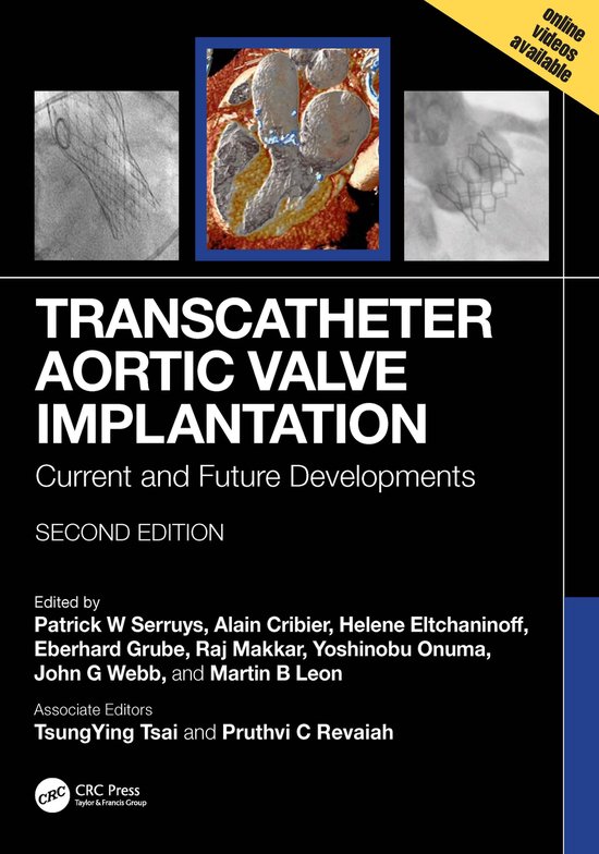 Transcatheter Aortic Valve Implantation | 9781032471471 | Boeken | bol