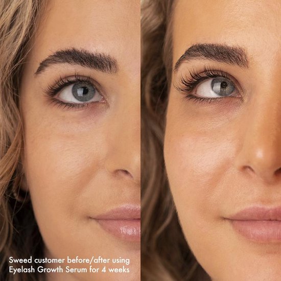 SWEED - Pro Eyelash Growth Serum 5 ml - wimper- en wenkbrauw groei ...