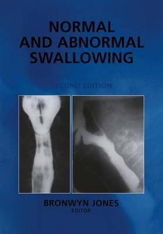 Normal and Abnormal Swallowing | 9781441929044 | Boeken | bol