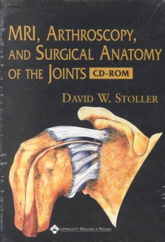 MRI, Arthroscopy,and Surgical Anatomy of the Joints, D. W. Stoller ...